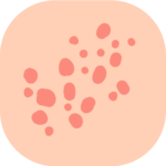 Entendiendo la psoriasis: qué es y por qué aparece - ISDIN