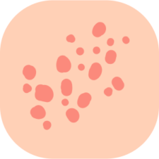 Entendiendo la psoriasis: qué es y por qué aparece - ISDIN