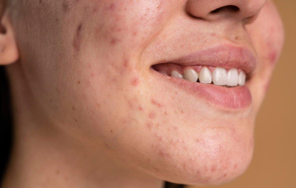 Carlos Alcaraz te invita a crear momentos mágicos, dentro y fuera de la ...