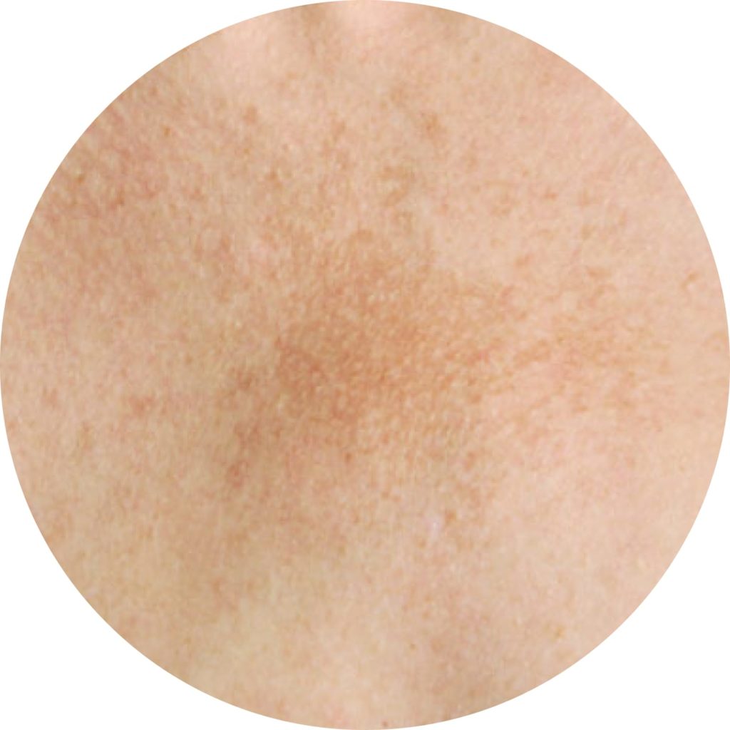 What is photoaging? Everything you need to know - ISDIN's blog