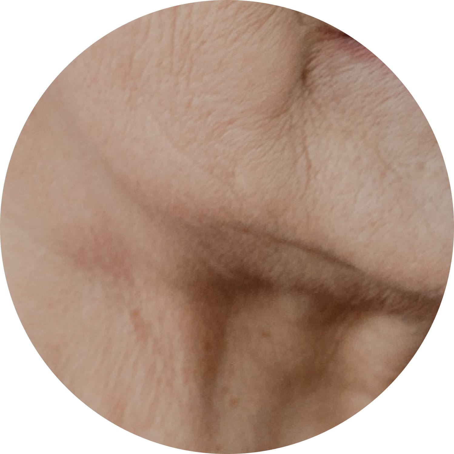 What is photoaging? Everything you need to know - ISDIN's blog