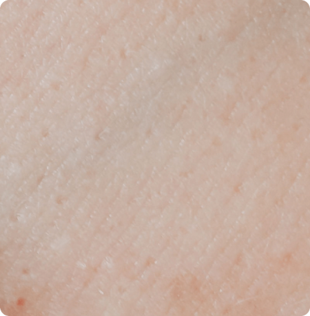 What is photoaging? Everything you need to know - ISDIN's blog