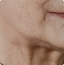 What is photoaging? Everything you need to know - ISDIN's blog