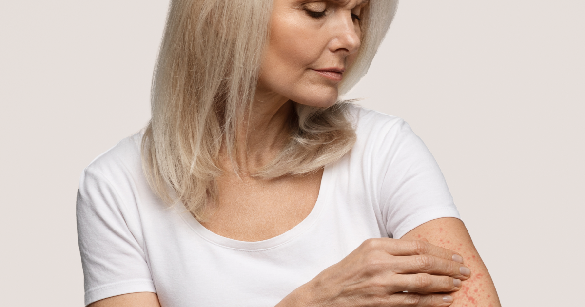 What Is Atopic Dermatitis (AKA Eczema)? | ISDIN