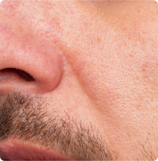 How To Pinpoint Your Skin Type (and Bring Out Its Best) | ISDIN