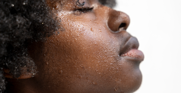 NMFs Explained: What They Do for Your Skin and How to Support Them
